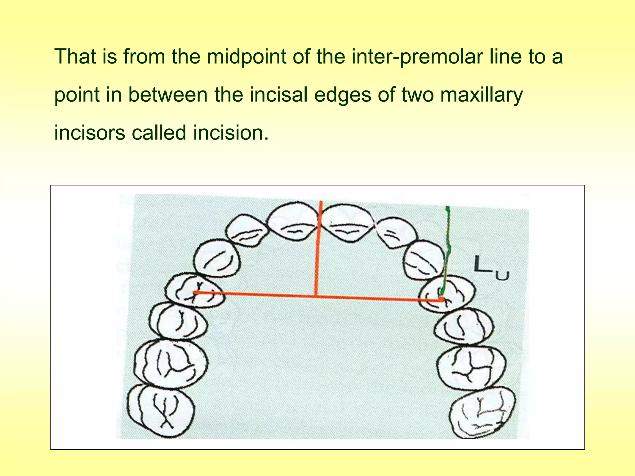 Model analysis.ppt