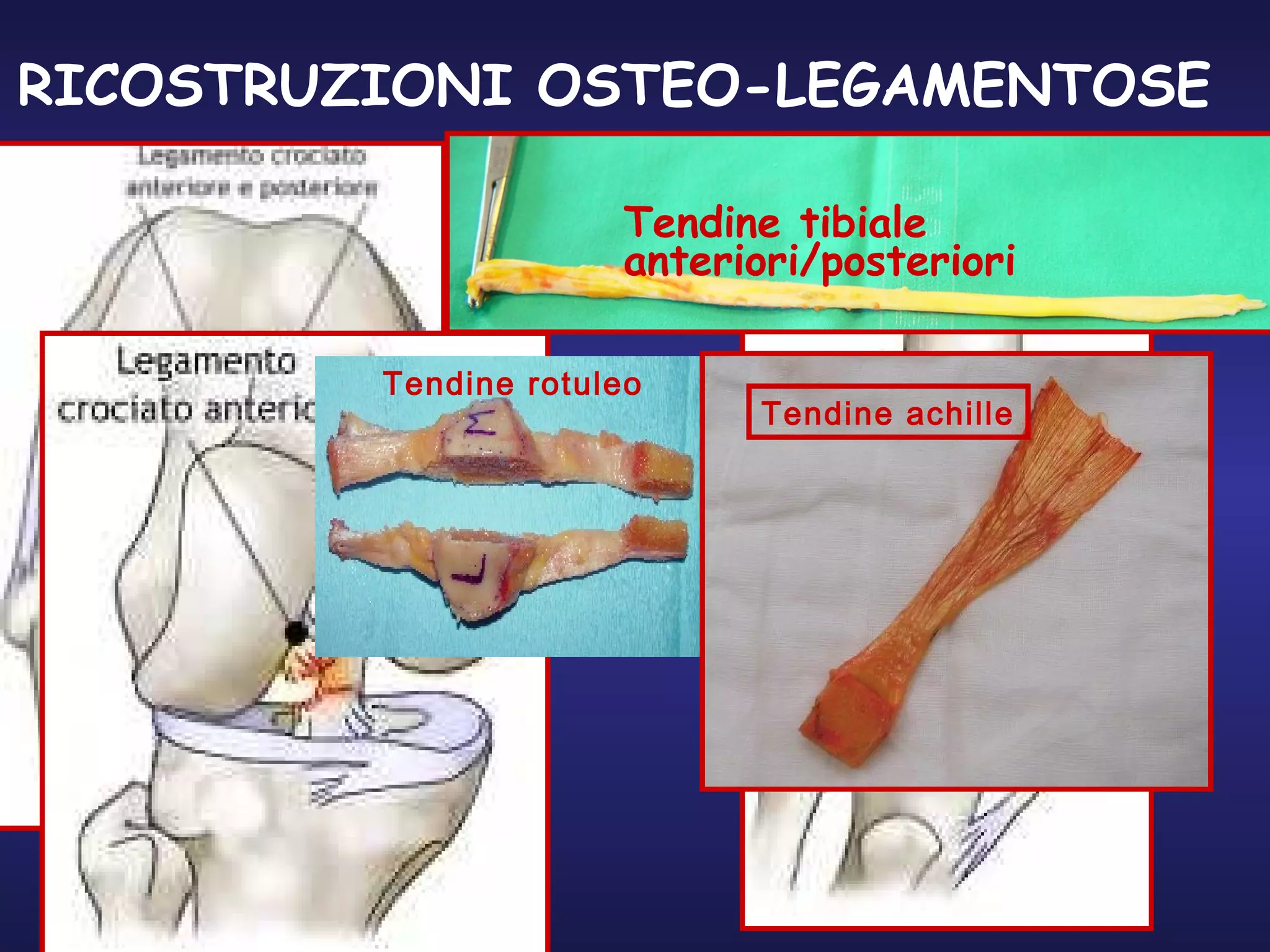 Modelli Organizzativi di Riferimento – Donazioni multitessuto | PPT