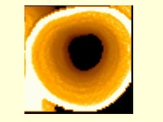Implementation of Charged Particles Deposition in Stochastic Lung Model ...