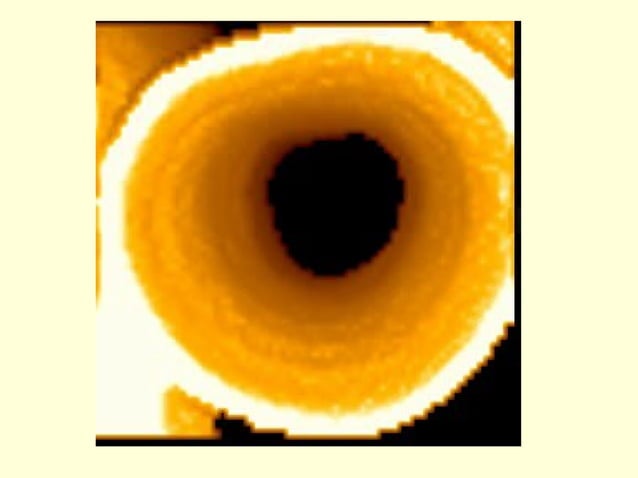 Implementation Of Charged Particles Deposition In Stochastic Lung Model And Calculation Of