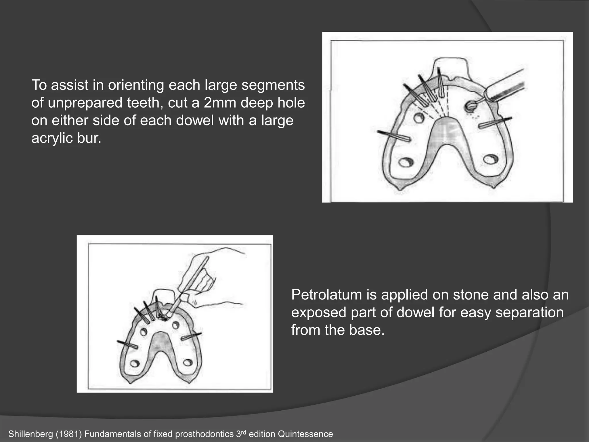 Model and die material | PPTX