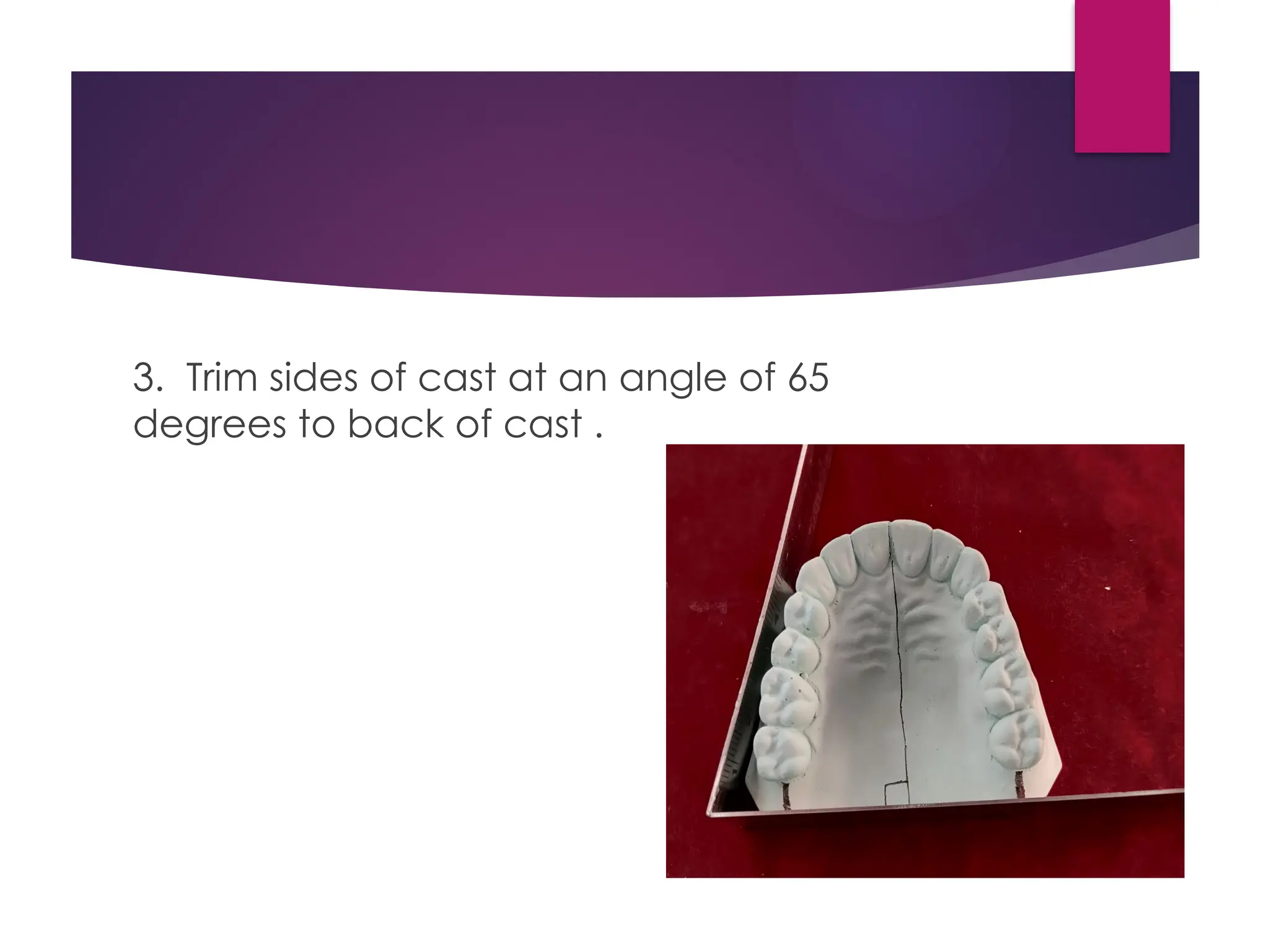 orthodontic study models presentation.pptx