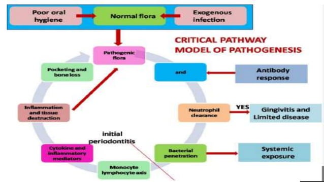MODELS OF PATHOGENESIS IN PERIODONTITIS (1).pptx | Dental Health ...