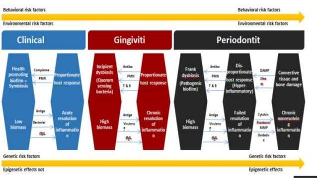 MODELS OF PATHOGENESIS IN PERIODONTITIS (1).pptx | Dental Health ...