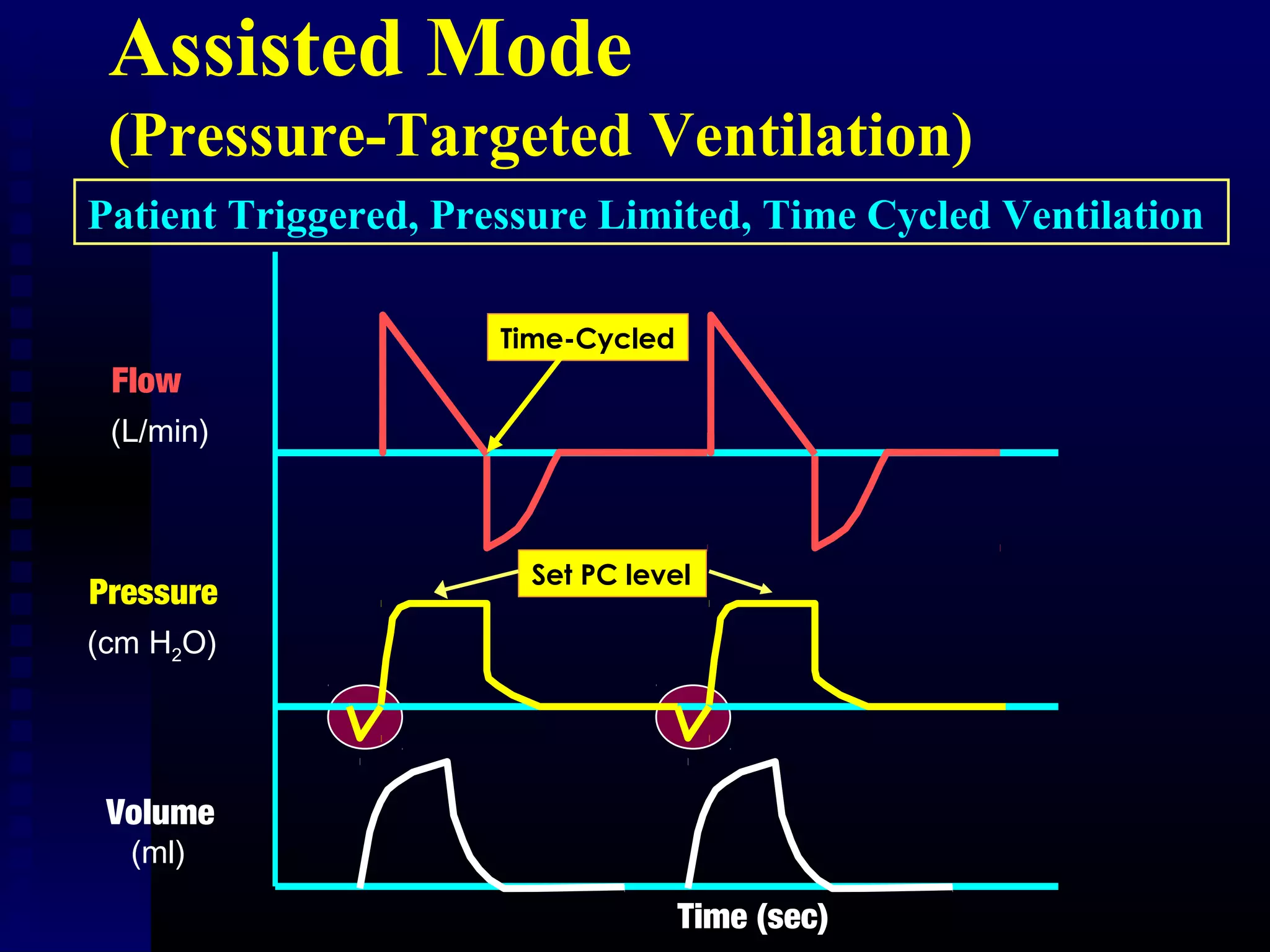 Mode of ventilation | PPT
