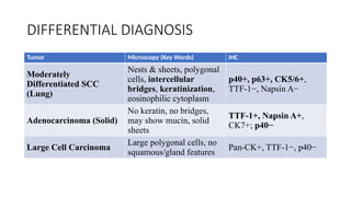 moderate squamous cell carcinoma disc.pptx