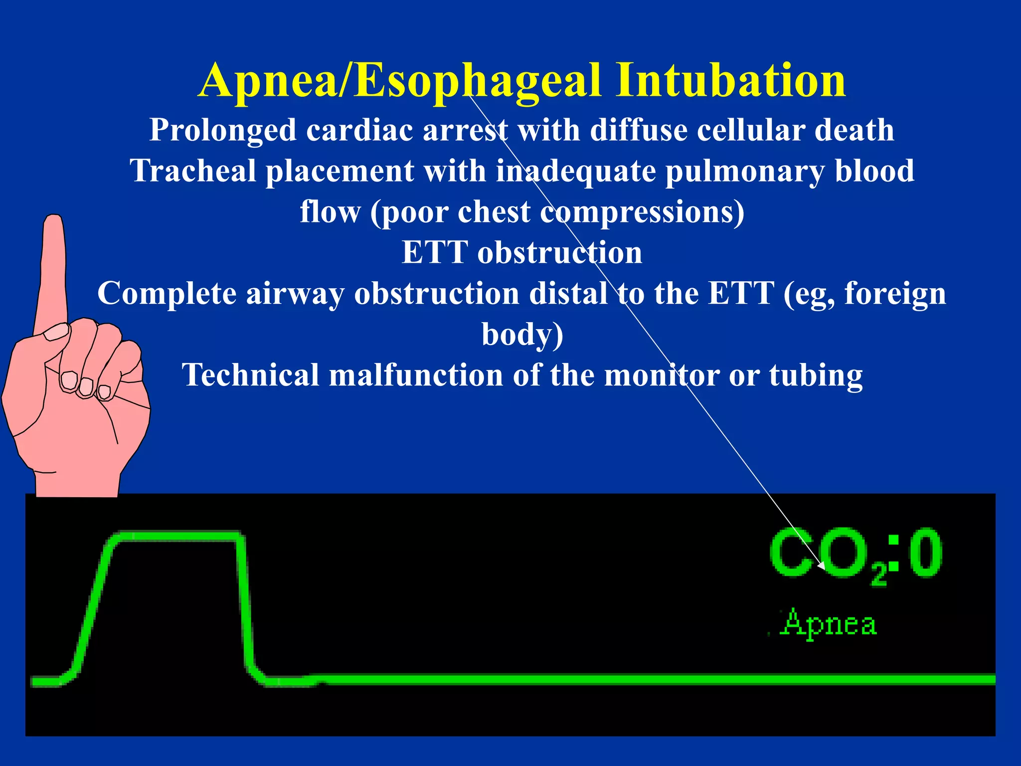 Moderate sedation monitoring | PPT