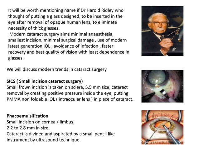 Modern cataract surgery | PPT