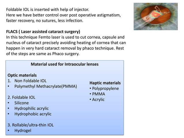 Modern cataract surgery | PPT