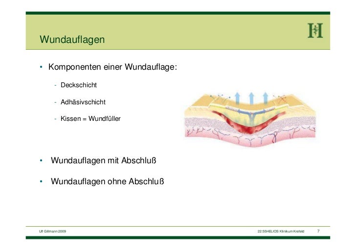 „Moderne“ Möglichkeiten der Wundtherapie