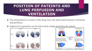 Modern Ventilator Management.pptx