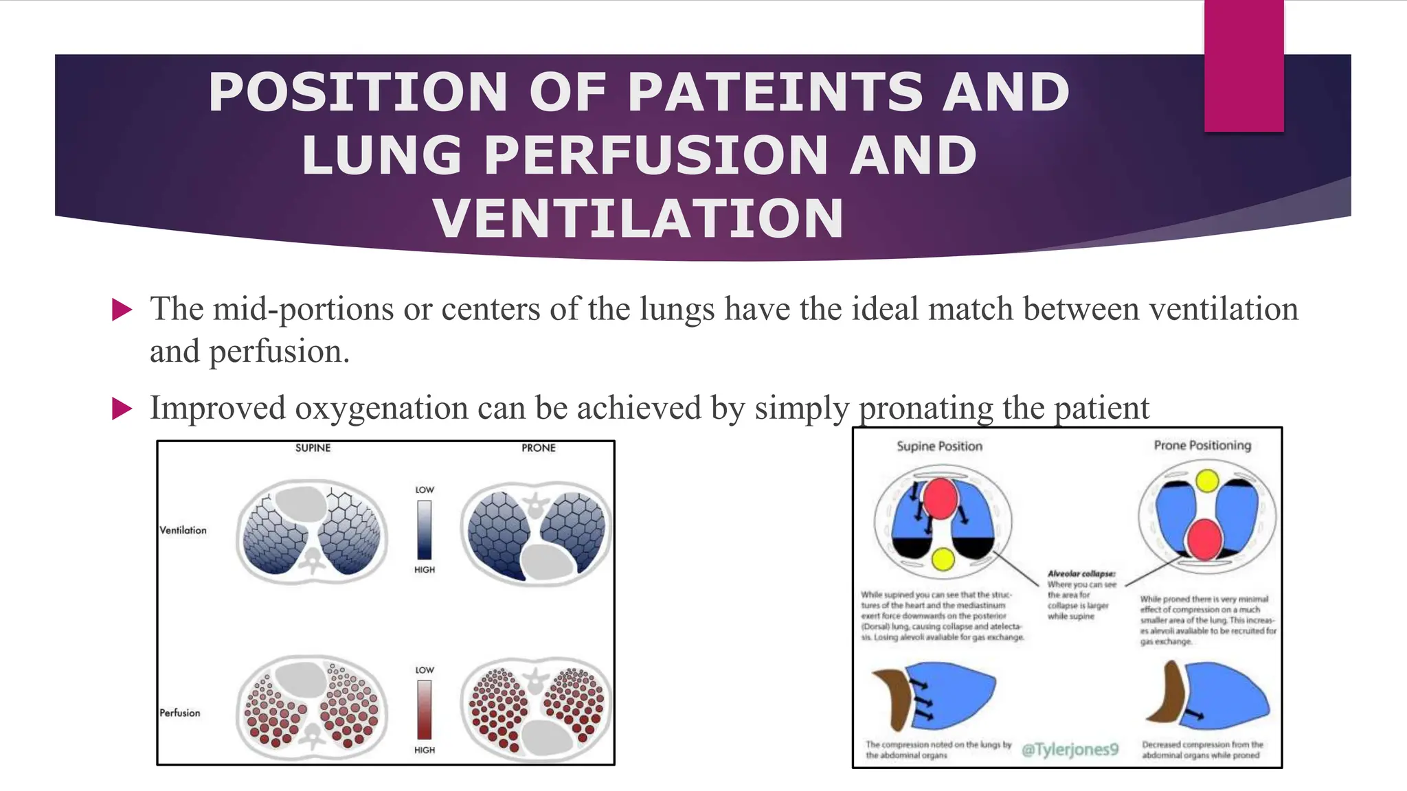 Modern Ventilator Management.pptx