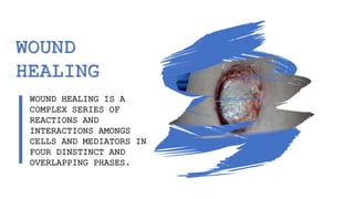 Modern wound care course | PPTX