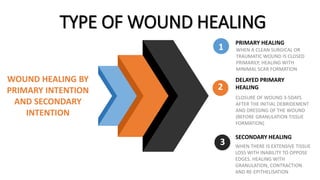 Modern wound care course | PPT