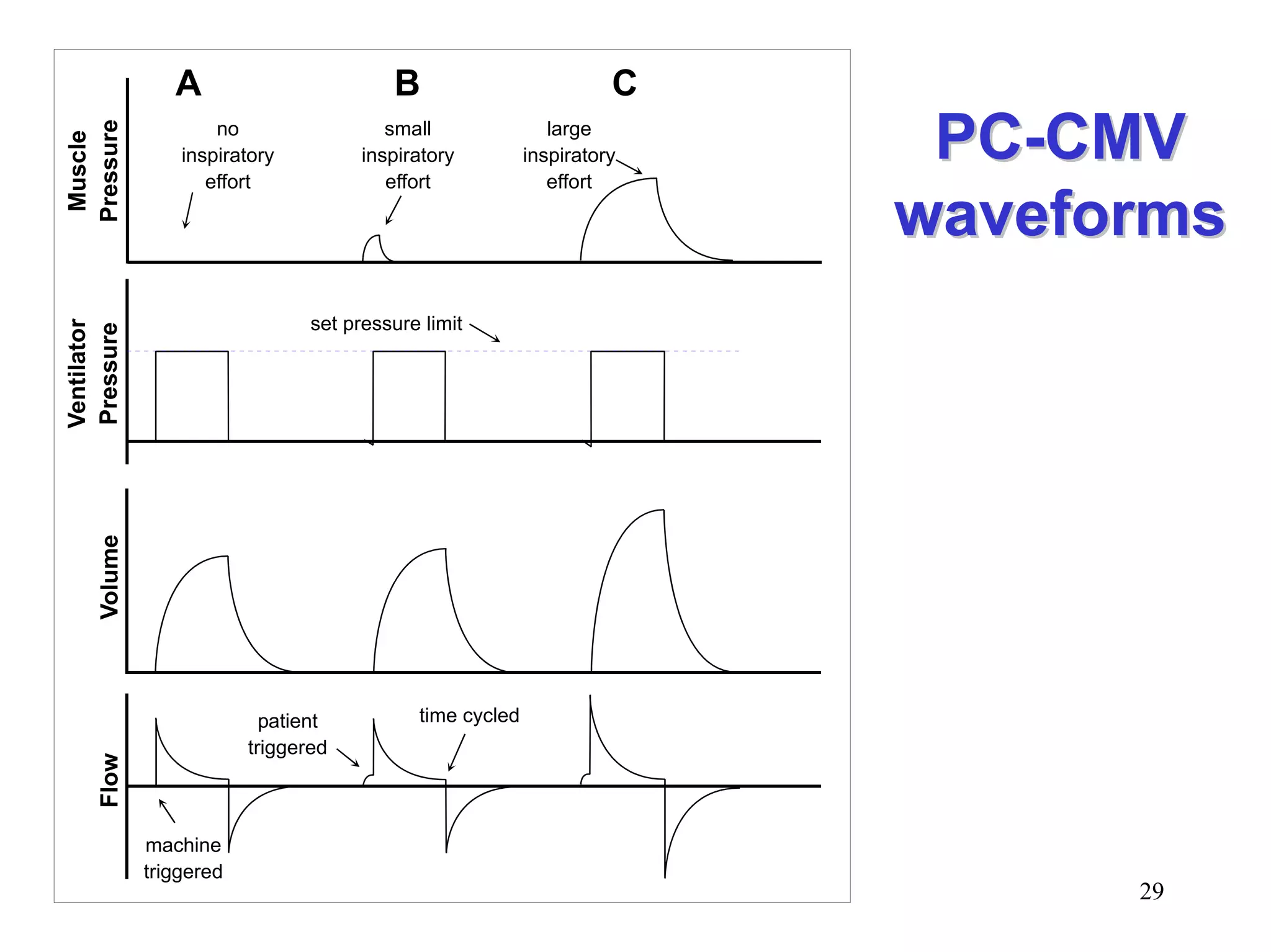Modes-of-Ventilation-NRRCC-2007.pdf
