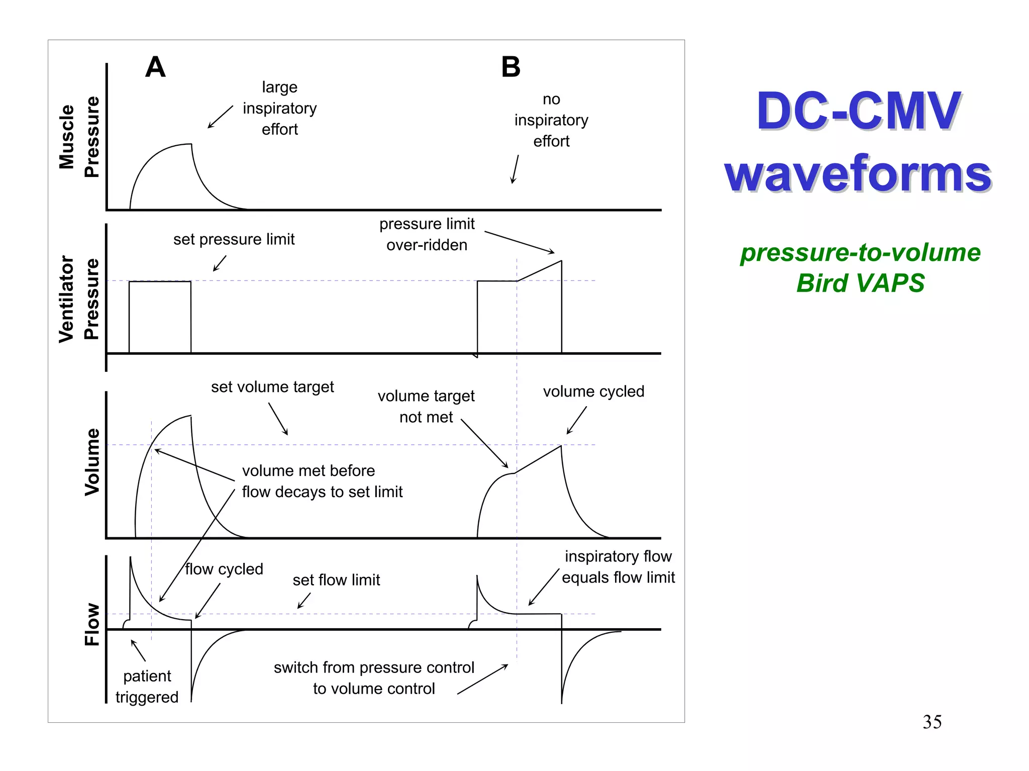 Modes-of-Ventilation-NRRCC-2007.pdf