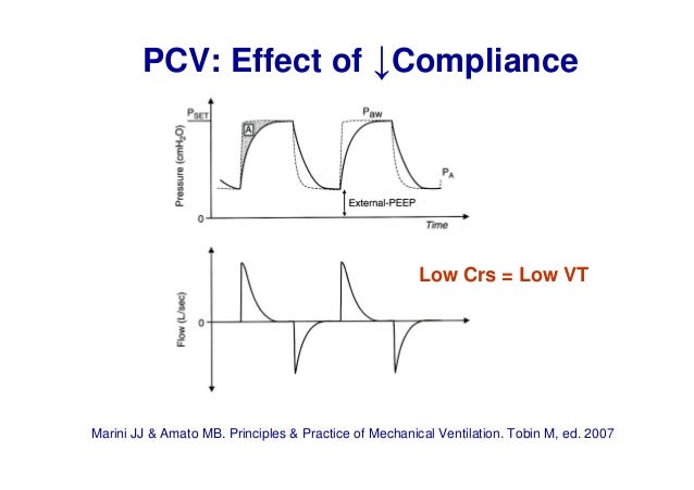 Modes of Mechanical Ventilation: The Essentials