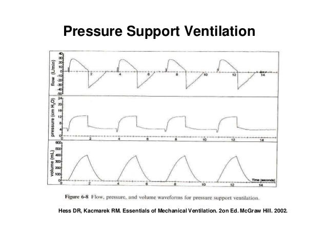 Modes of Mechanical Ventilation: The Essentials