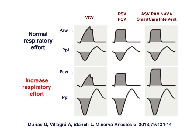 Modes of Mechanical Ventilation: The Essentials