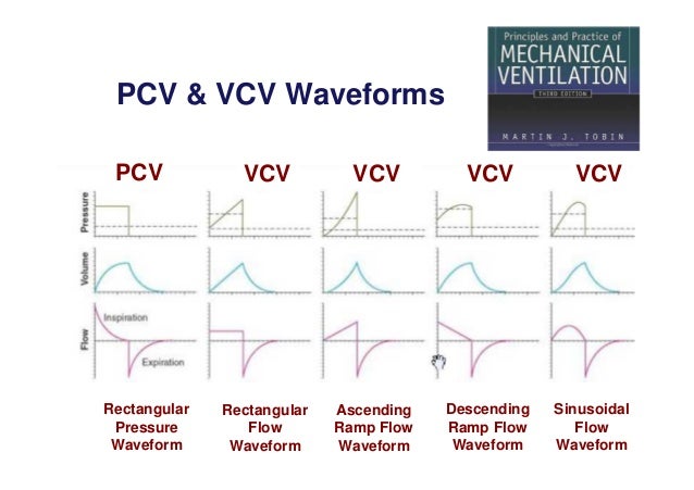 Modes of Mechanical Ventilation: The Essentials