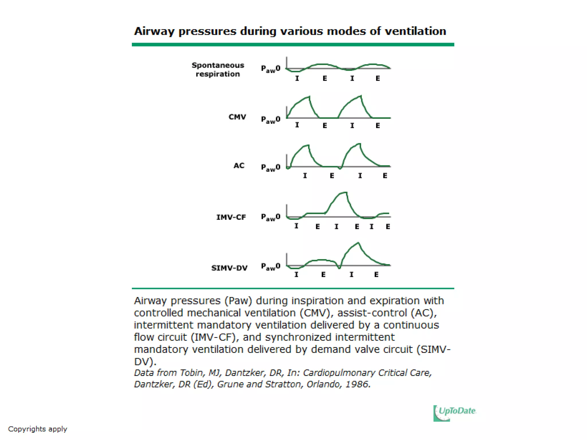 Modes of ventilation and bipap sept 2011 | PPT