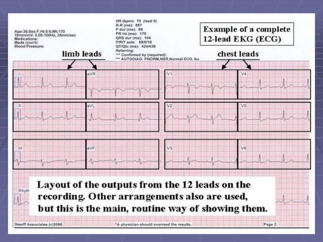 mod_i-12_lead_ekgs.ppt | Heart and Cardiovascular Diseases | Diseases ...