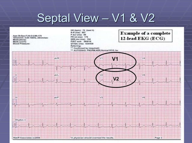 mod_i-12_lead_ekgs.ppt | Heart and Cardiovascular Diseases | Diseases ...