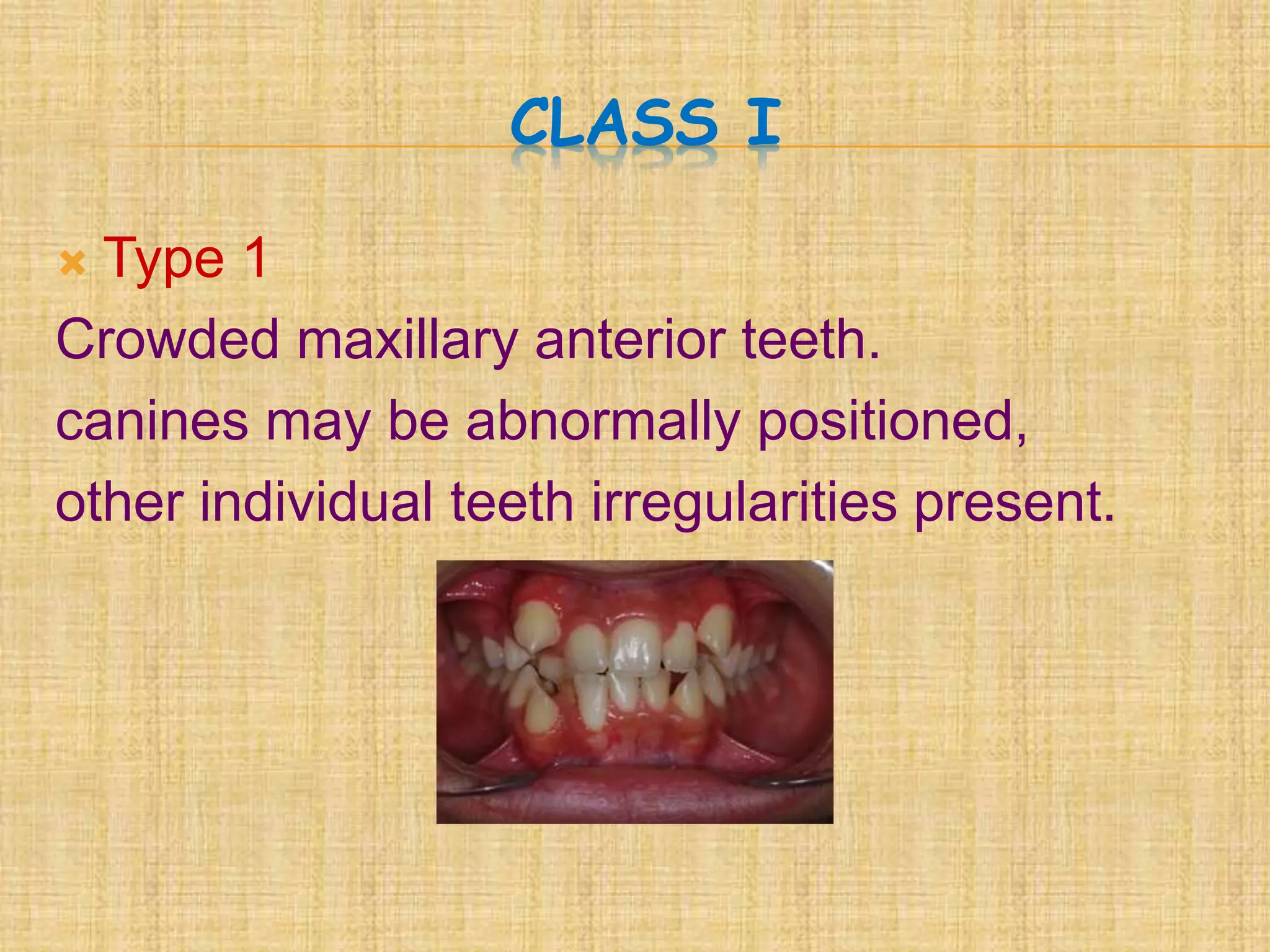 Modifications of angle`s classification | PPTX