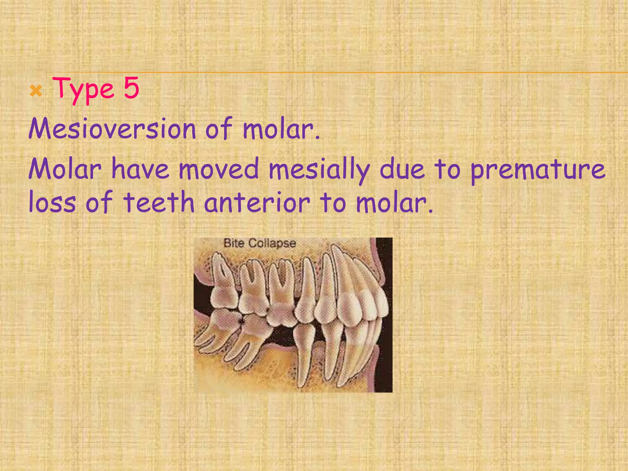 Modifications of angle`s classification | PPTX