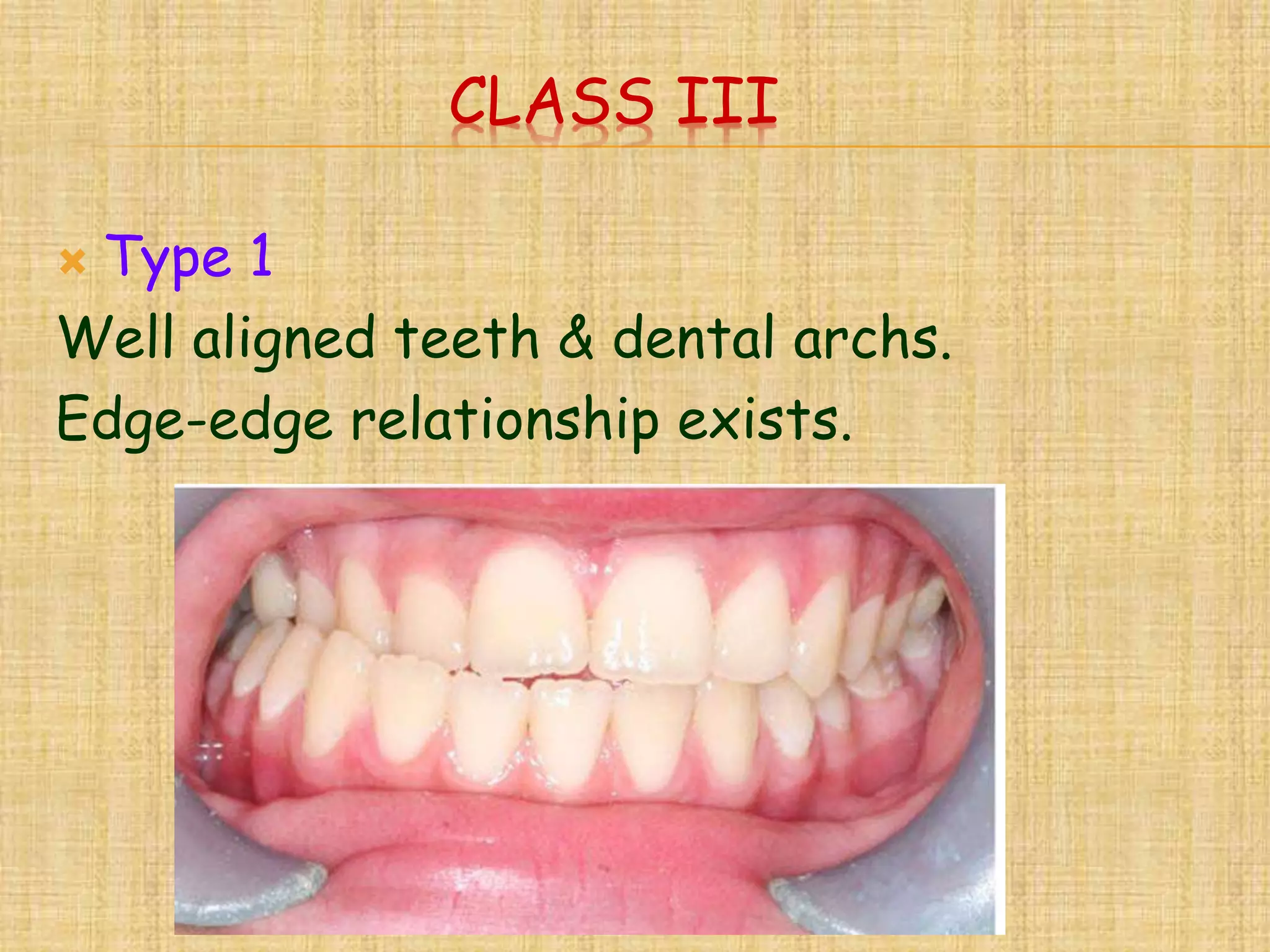 Modifications of angle`s classification | PPTX
