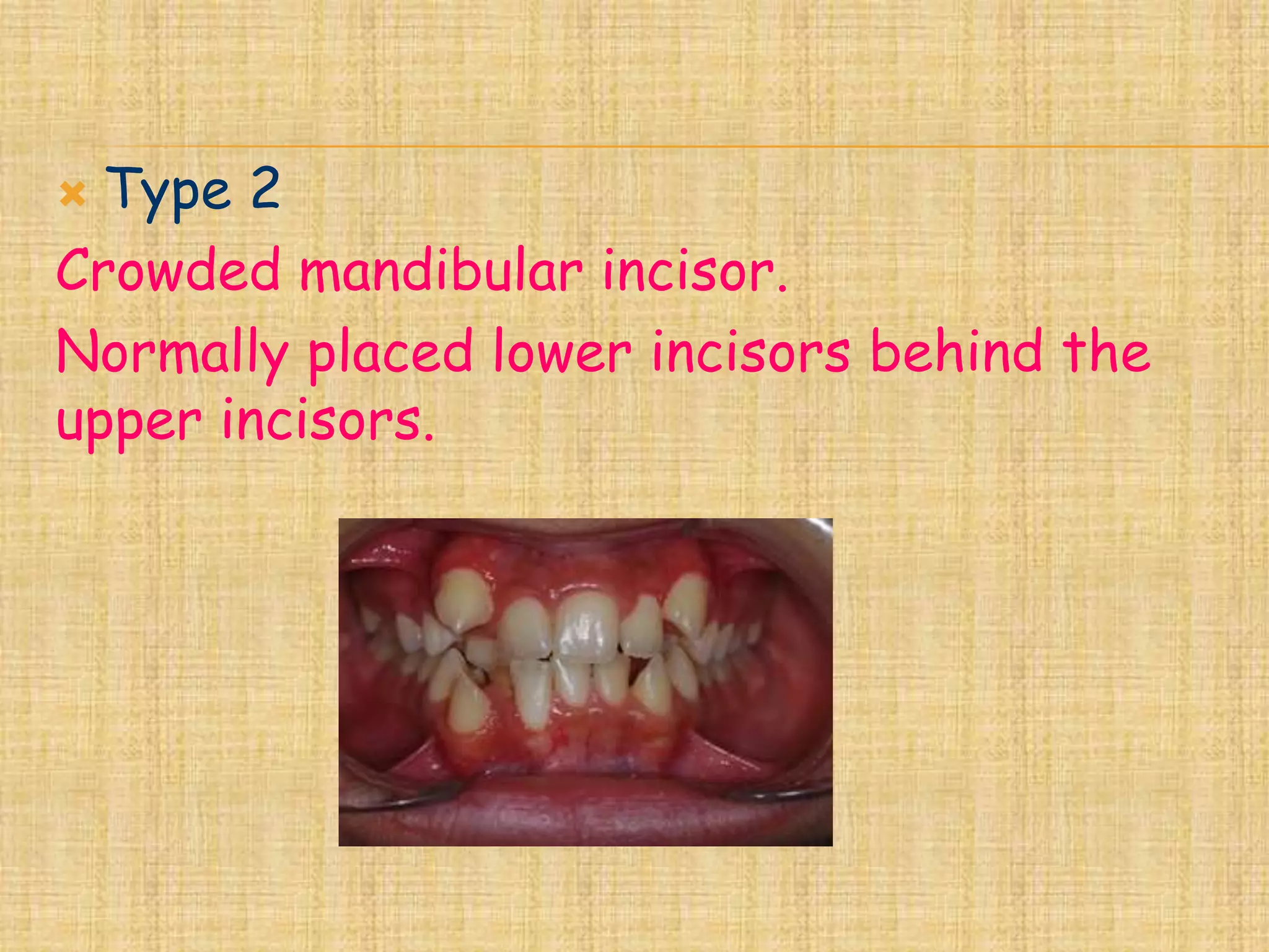 Modifications of angle`s classification | PPTX