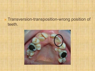 Modifications of angle`s classification | PPTX