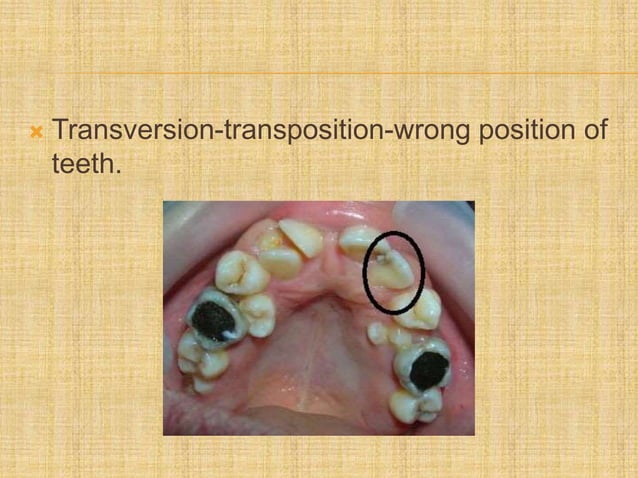 Modifications of angle`s classification | PPTX