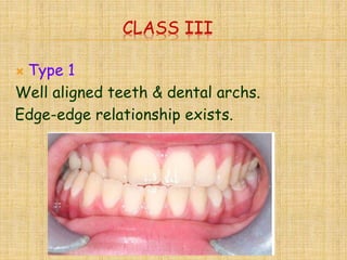Modifications of angle`s classification | PPTX