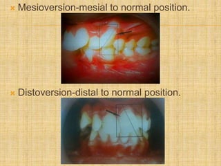Modifications of angle`s classification | PPTX