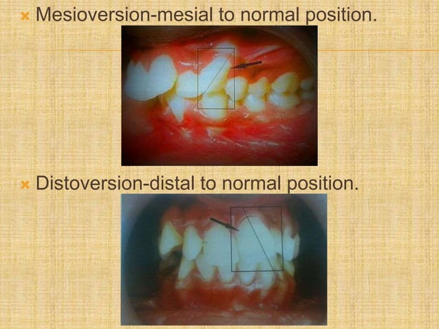 Modifications of angle`s classification | PPTX