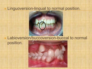 Modifications of angle`s classification | PPTX