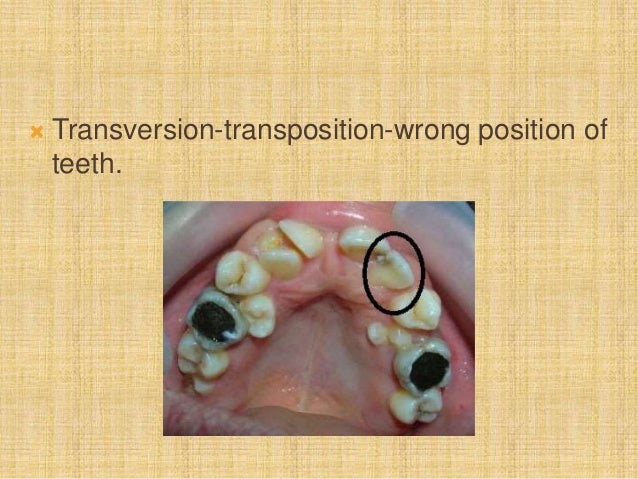 Modifications of angle`s classification