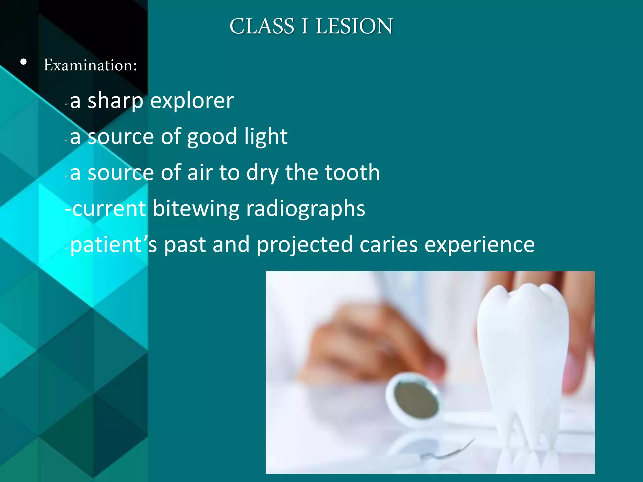 Modifications of cavity preparations in pediatric dentistry | PPTX