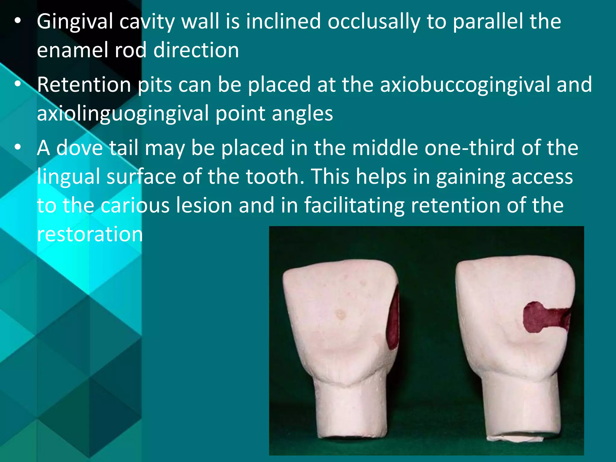 Modifications of cavity preparations in pediatric dentistry | PPTX