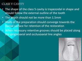 Modifications of cavity preparations in pediatric dentistry | PPTX