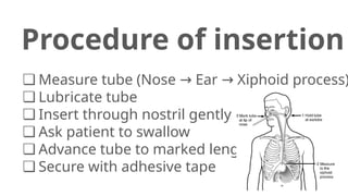 Comprehensive Guide to Nasogastric (NG) Tube Insertion and Removal ...