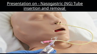 Comprehensive Guide to Nasogastric (NG) Tube Insertion and Removal ...