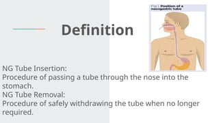 Comprehensive Guide to Nasogastric (NG) Tube Insertion and Removal ...
