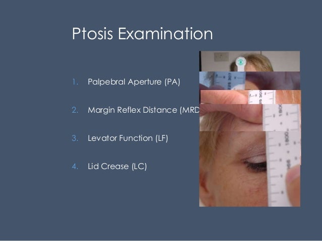 Adult & Paediatric Ptosis