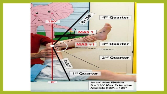 Modified ashworth scale application | PDF | Death, Injury, or Military ...