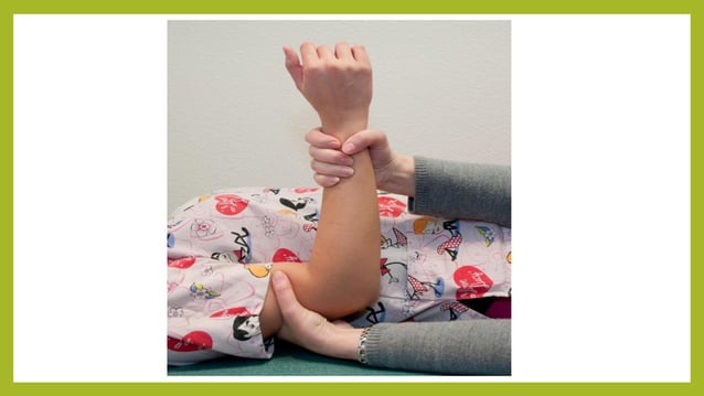 Modified ashworth scale application | PPT