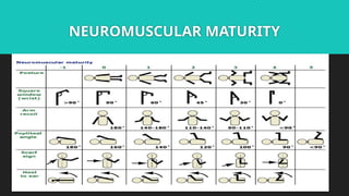 Modified Ballard score and newborn maturity | PPT
