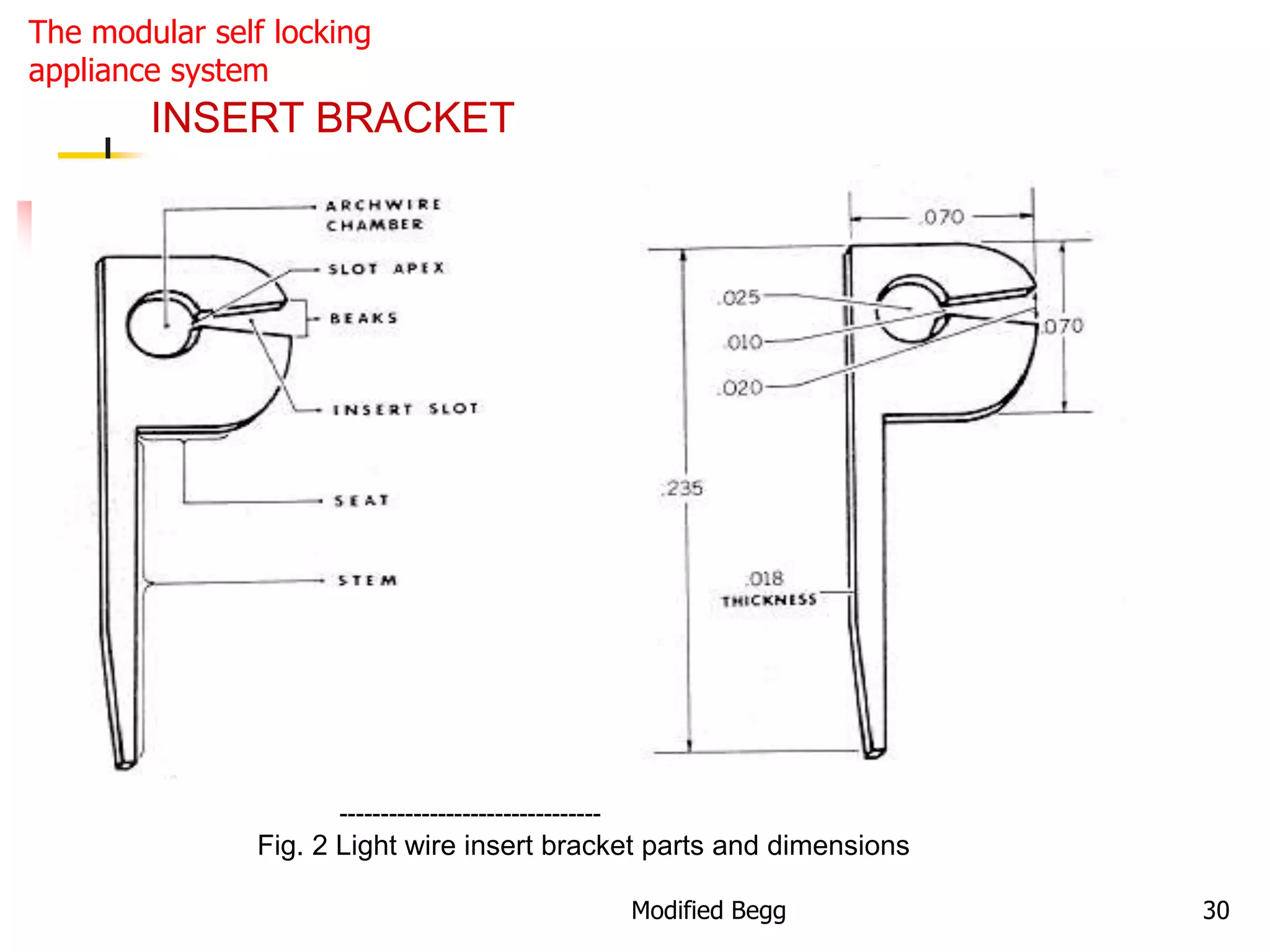 Modified begg orthodontics | PPT