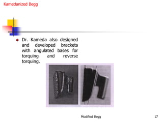 Modified begg orthodontics | PPT